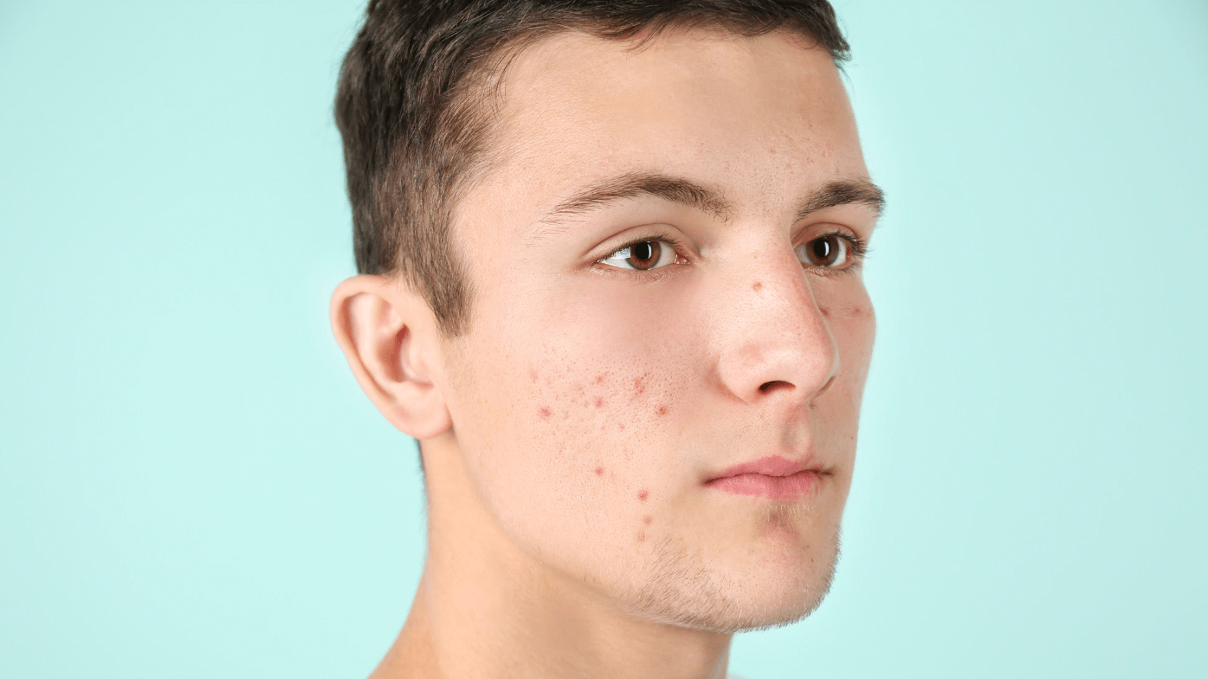 Can Laser Skin Resurfacing Help Reduce Facial Scars?
